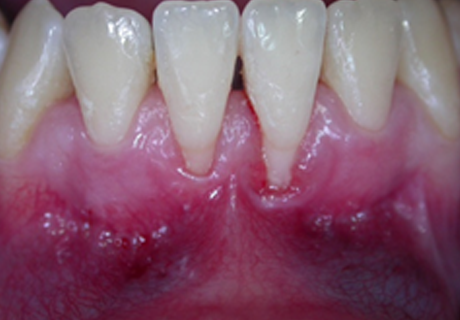 Periodontologia